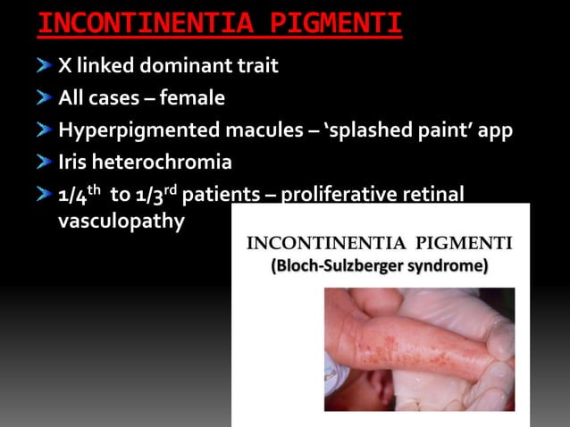 ANATOMY OF IRIS AND ITS CONGENITAL ANOMALIES | PPTX | Eye and Vision ...