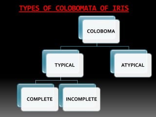 ANATOMY OF IRIS AND ITS CONGENITAL ANOMALIES | PPTX