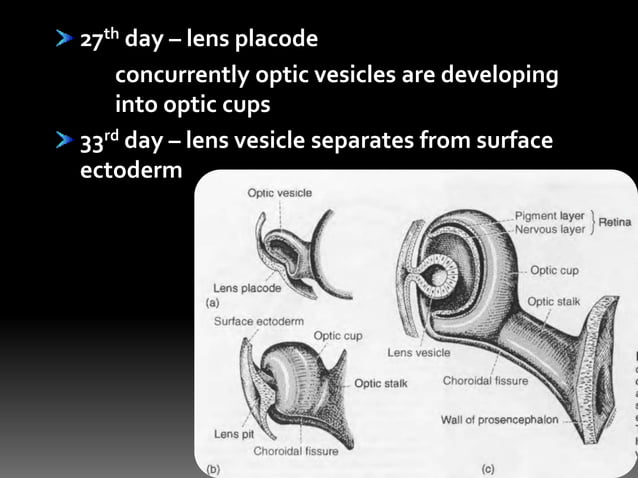 ANATOMY OF IRIS AND ITS CONGENITAL ANOMALIES | PPTX | Eye and Vision ...