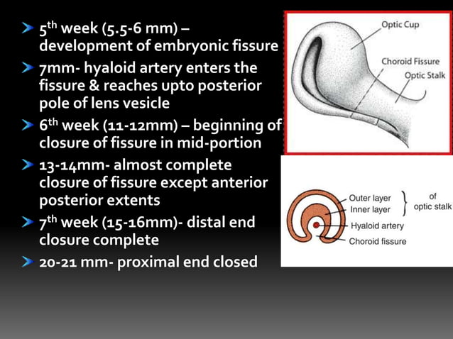 ANATOMY OF IRIS AND ITS CONGENITAL ANOMALIES | PPTX | Eye and Vision ...