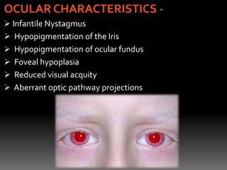 ANATOMY OF IRIS AND ITS CONGENITAL ANOMALIES | PPTX