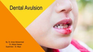 dental avulsion.pptx