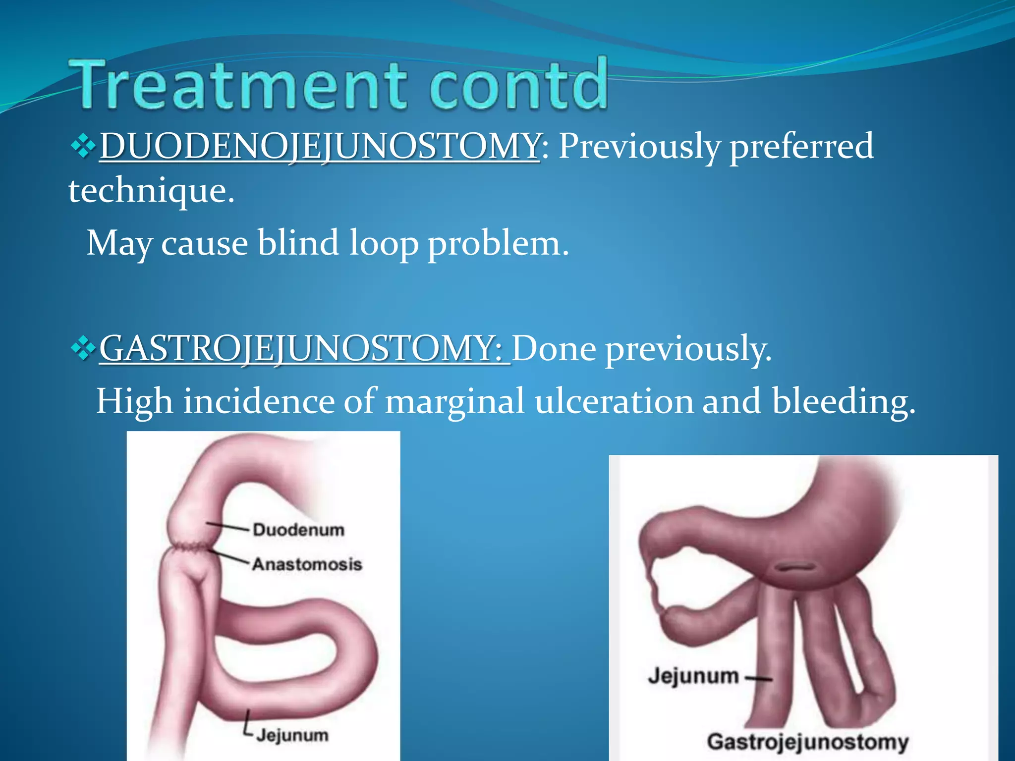 Duodenal Atresia Ppt