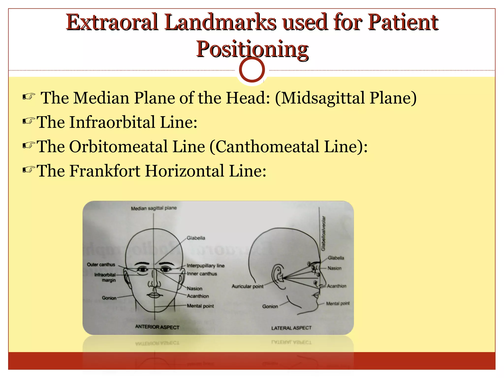 Seminar extra oral radiograph | PPT | Death, Injury, or Military ...