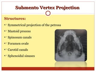 Seminar extra oral radiograph | PPT