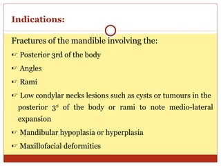 Seminar extra oral radiograph | PPT