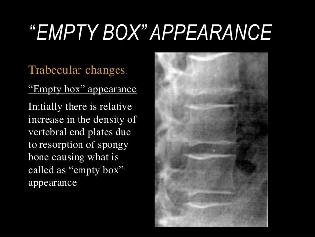 metabolic bone disorders