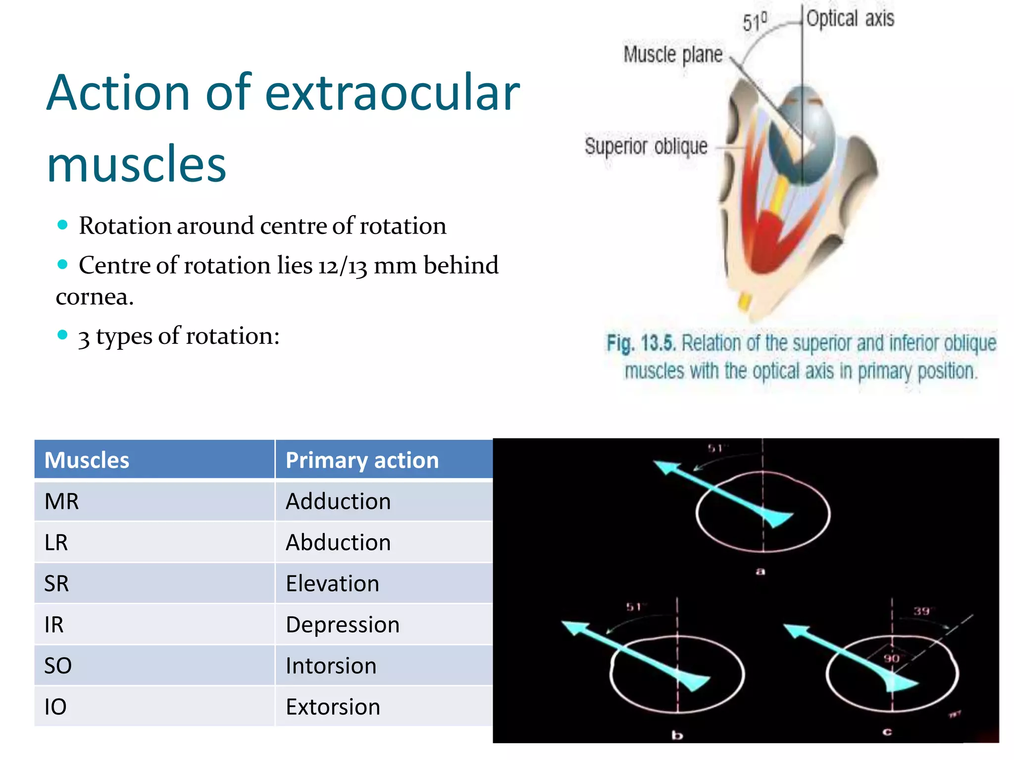 strabismus | PPTX