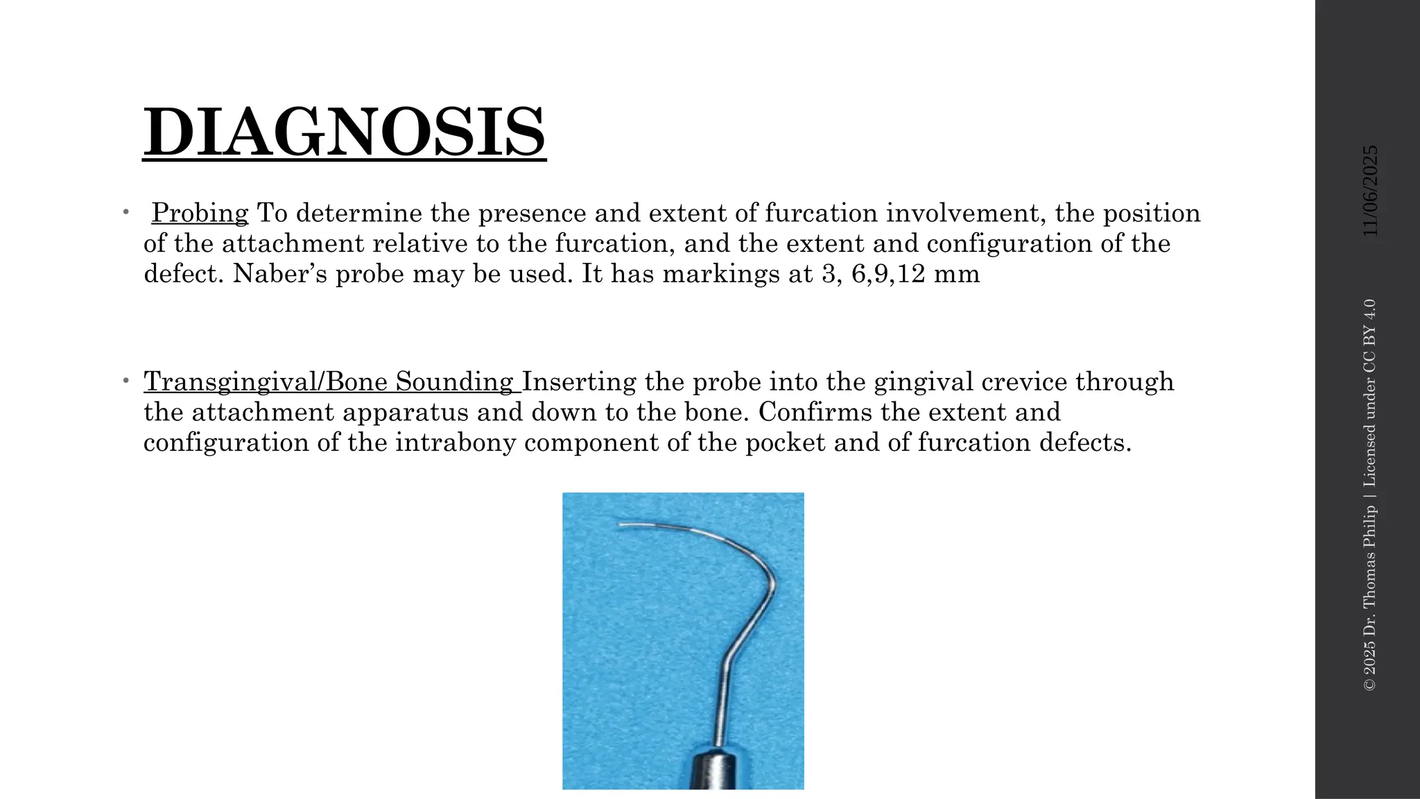 FURCATION INVOLVEMENT & MANAGEMENT - Seminar.pptx