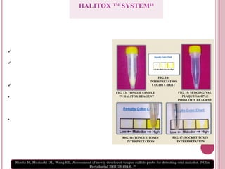 Seminar Halitosis | PPT