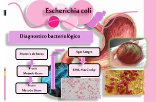E. Coli | PPTX