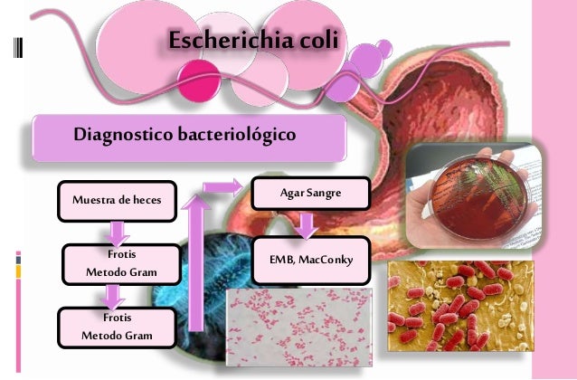 ¿Cuál Es La Forma Más Frecuente De Contraer Una Infección Por E.Coli – VVME
