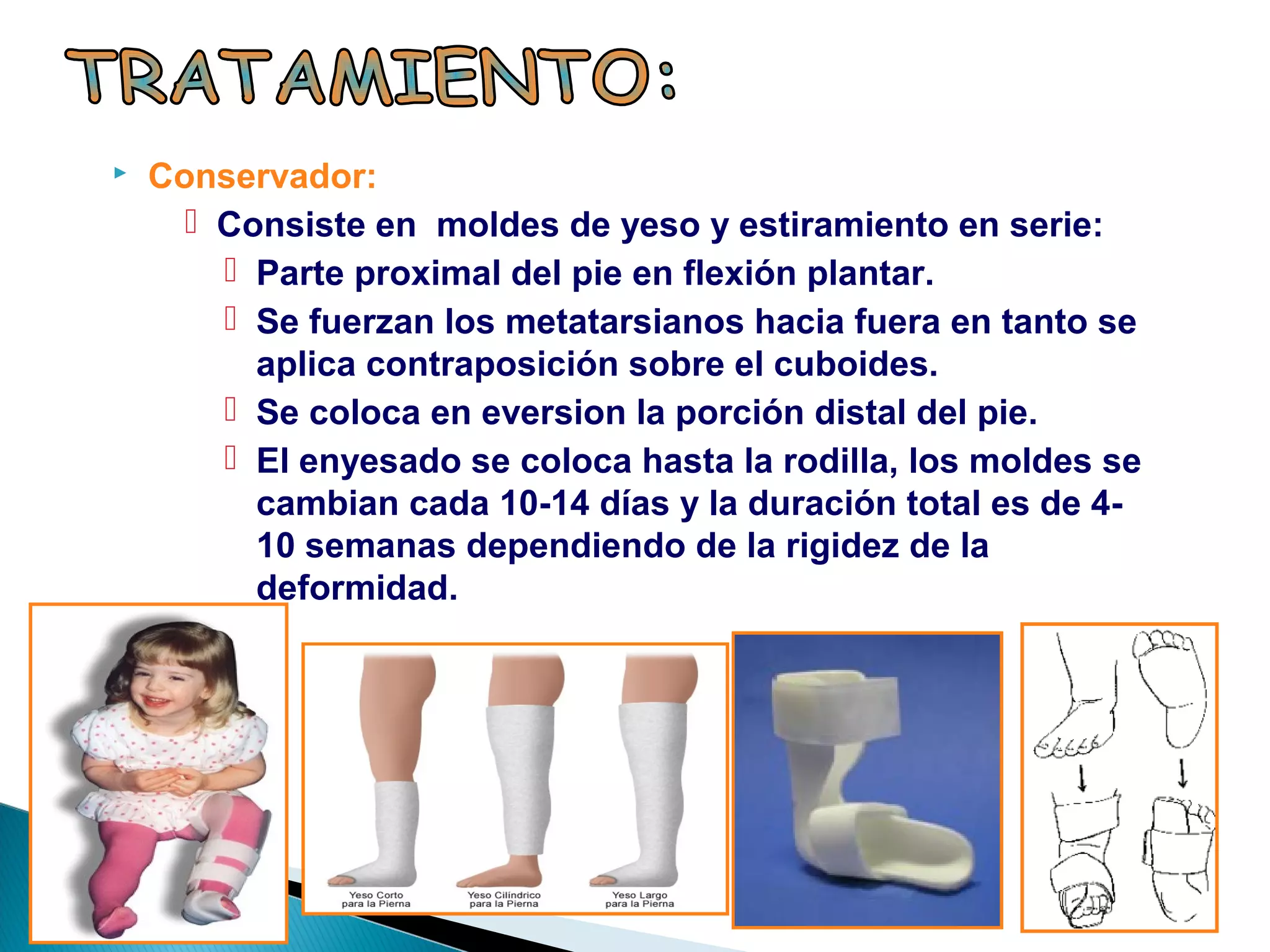 Pie cavus, Hallux valgus. Dedo en martillo, en resorte y en garra, Pie ...