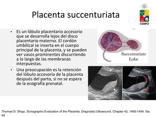 seminario-64-evaluacion-ecografia-de-placenta_archivo.pdf
