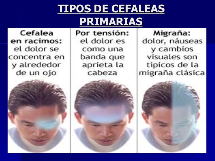 Prevención Cefalea y Algias Faciales - Tu informativo