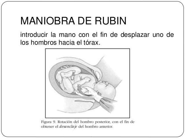 CUIDADO DE ENFERMERIA EN PRESENCIA DE DISTOCIAS DE ORIGEN FETAL Y MAT…