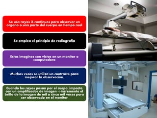 Fluoroscopia-Diagnóstico por Imagenes | PPTX