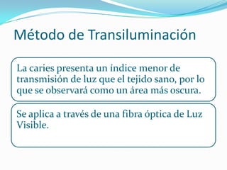 Métodos diagnósticos de caries | PPTX