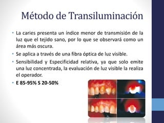 Métodos Diagnósticos de caries | PPTX