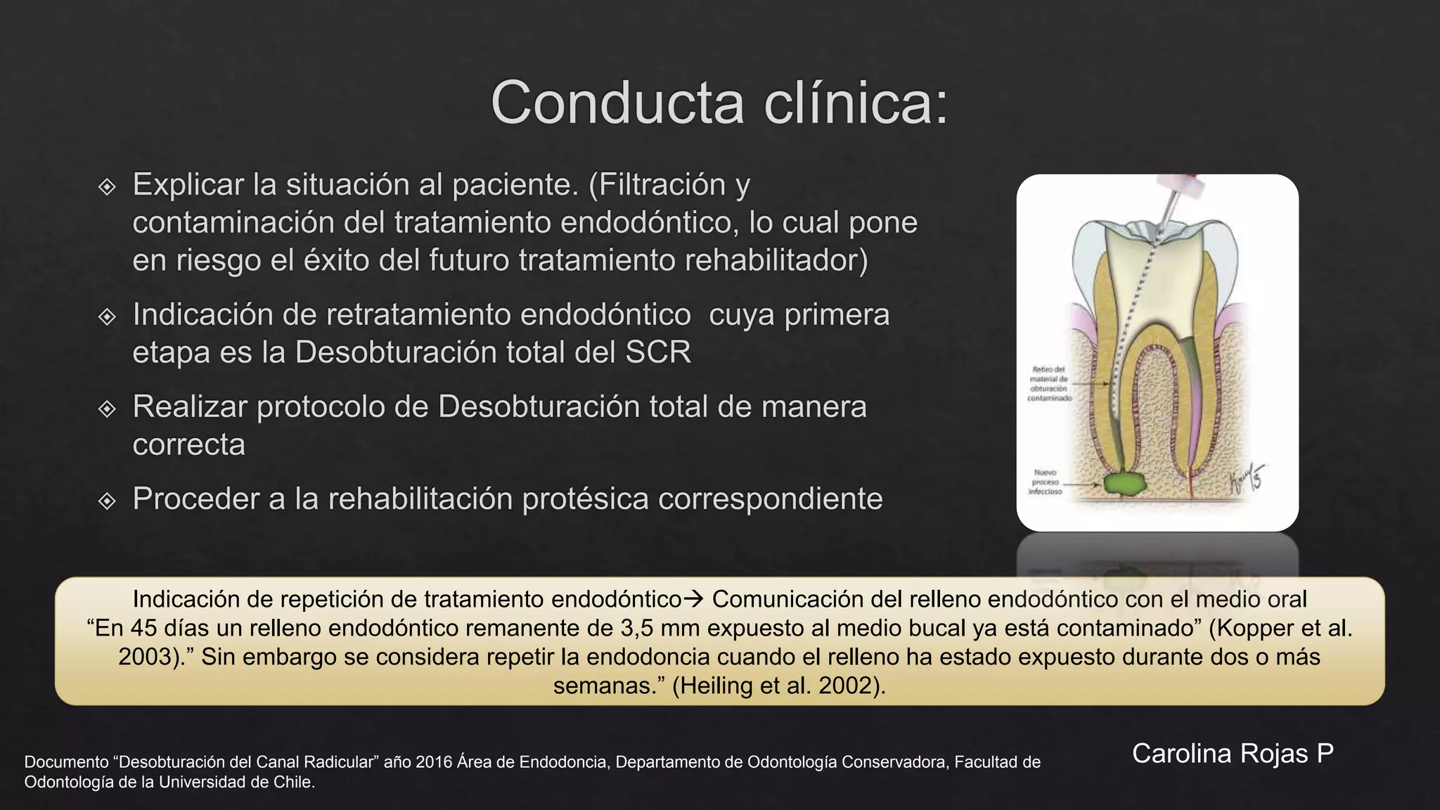 Seminario 9 desobturación de canal radicular | PPT