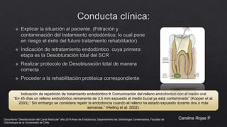 Seminario 9 desobturación de canal radicular | PPTX