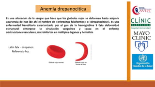 Seminario anemia drepanocitica perinato | PPTX