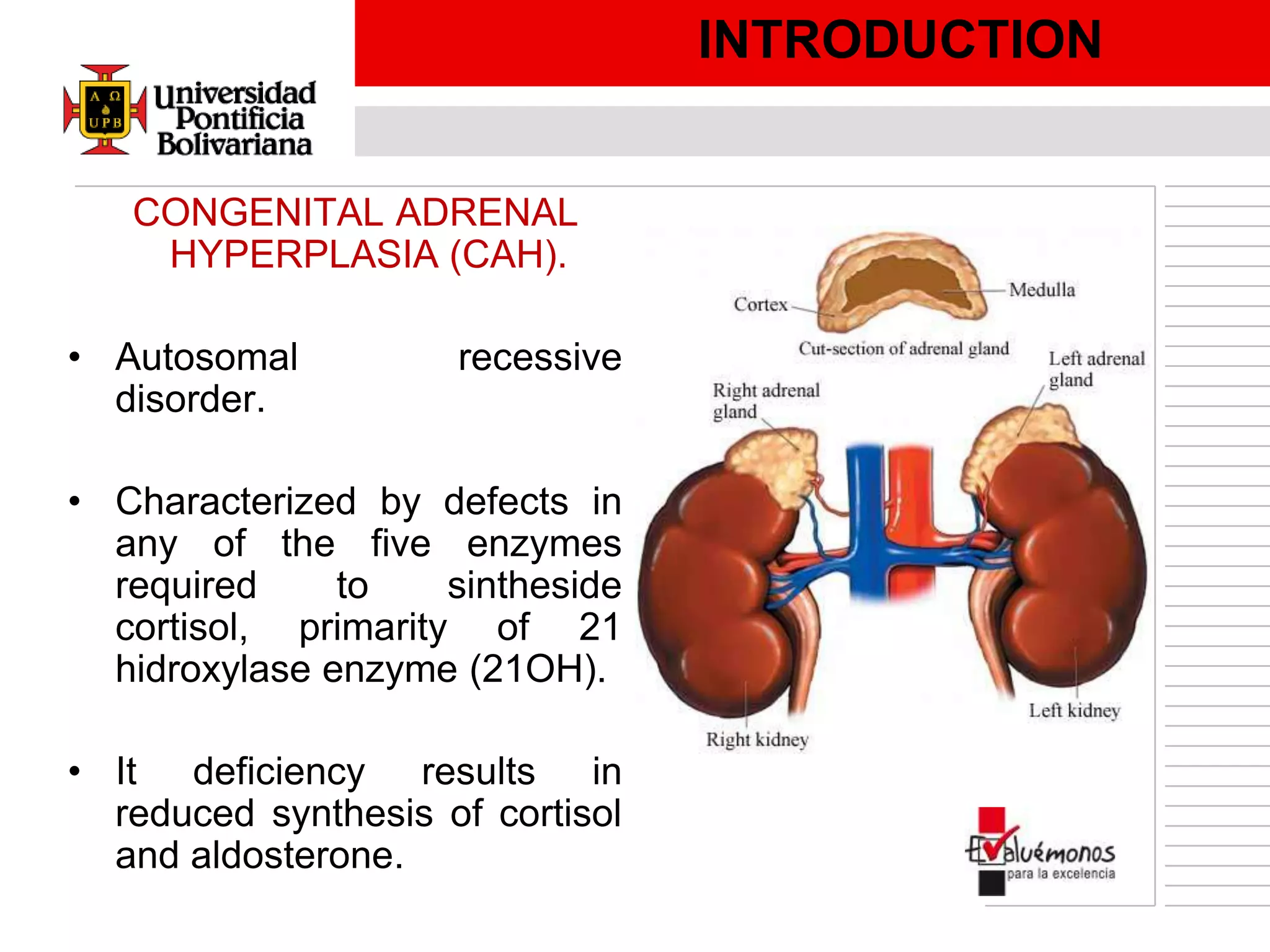 Congenital Adrenal Hyperplasia (CAH) | PPTX