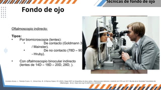 FONDO DE OJO NORMAL EN OFTALMOLOGIA1epptx | PPTX