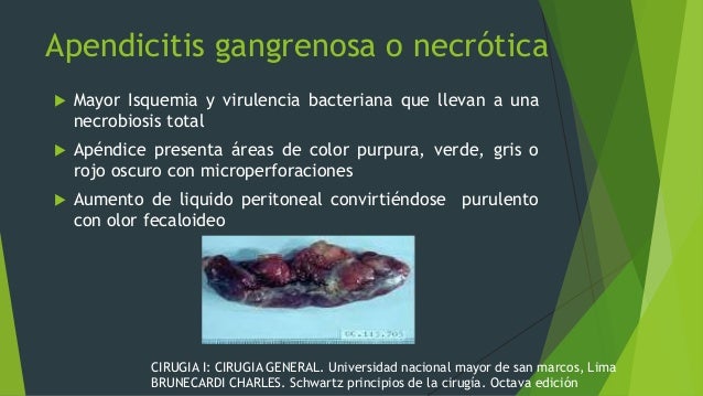 apendicitis aguda