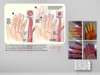 Seminario de cianosis | PPTX