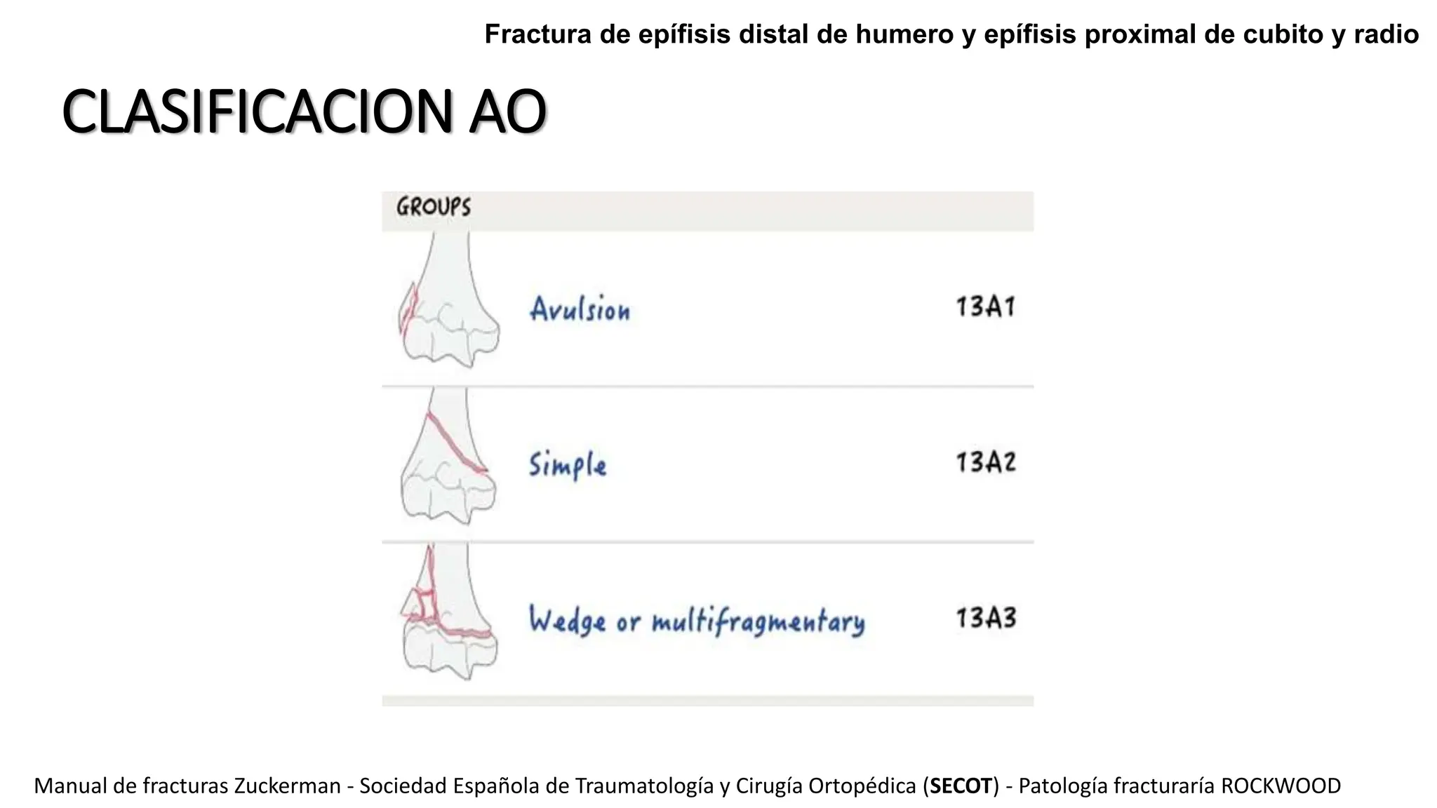 seminario de fracturas de humero dista.pptx