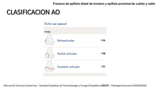 seminario de fracturas de humero dista.pptx