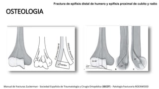 seminario de fracturas de humero dista.pptx