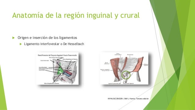 hernia inguinal y crural