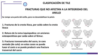 Fracturas de pelvis y cadera osea medici | PPTX