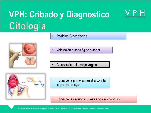 VPH (Virus del Papiloma Humano)