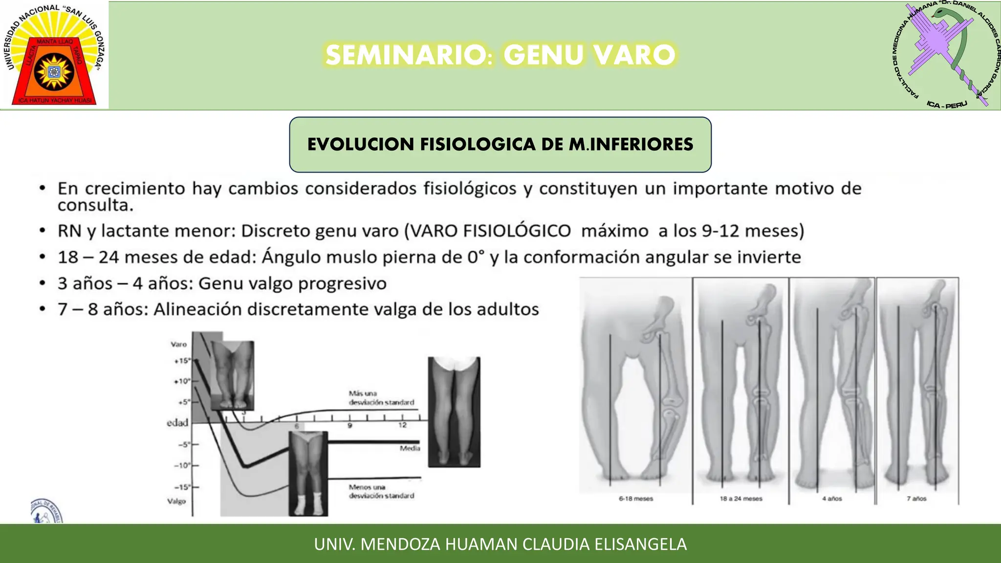 SEMINARIO DISPLASIA CONGENITA DE CADERA^J GENU VARO^J GENU VALGO Y PIE ...