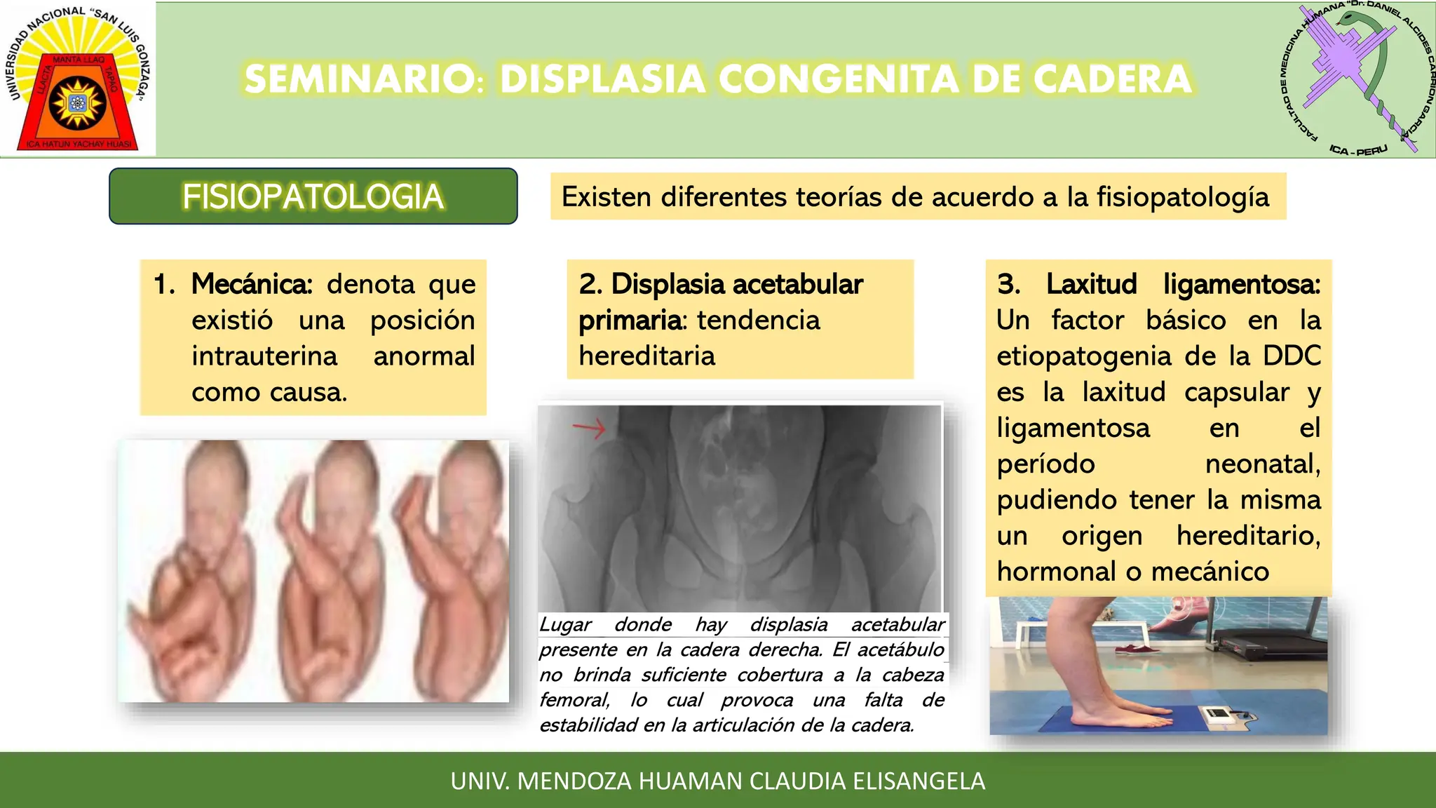 SEMINARIO DISPLASIA CONGENITA DE CADERA^J GENU VARO^J GENU VALGO Y PIE ...