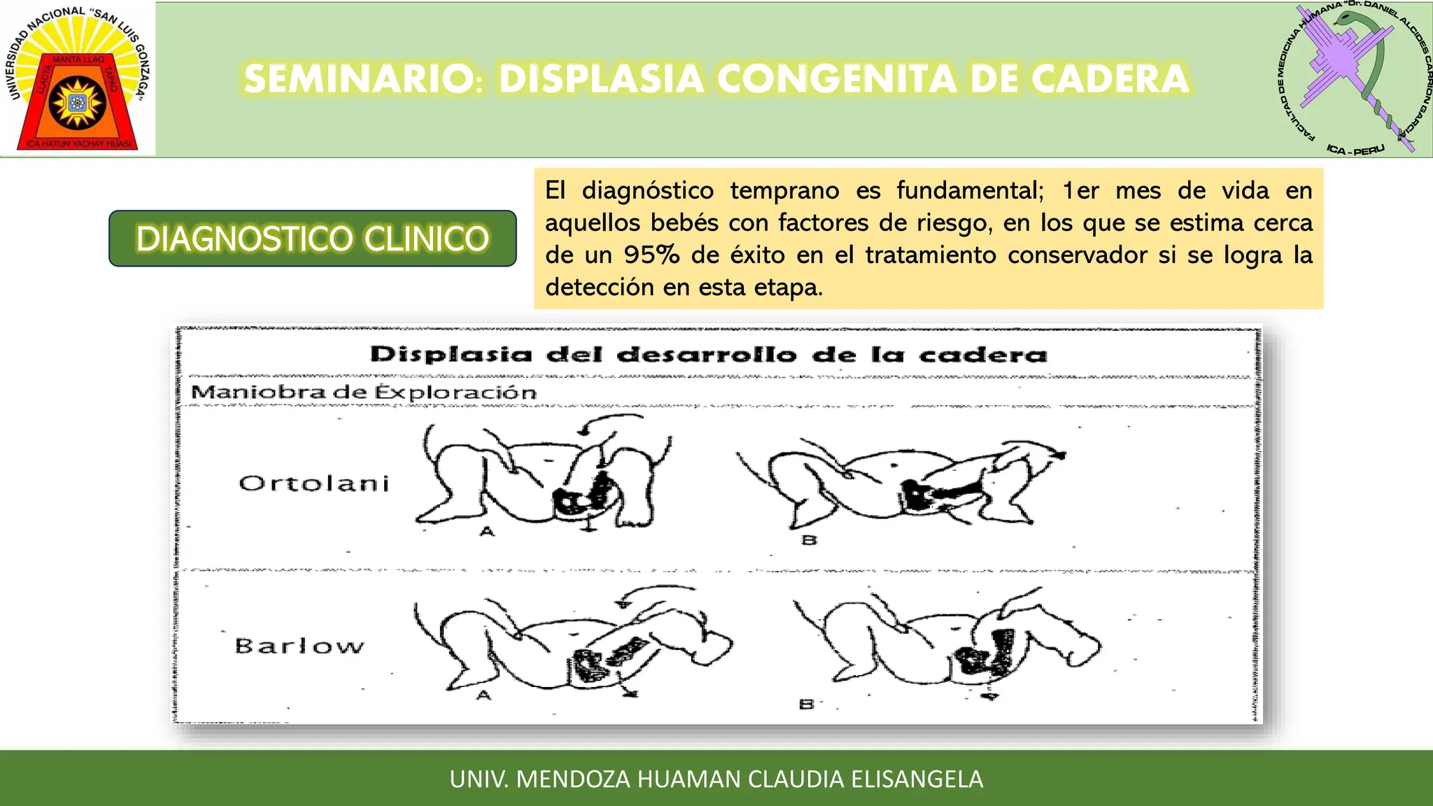 SEMINARIO DISPLASIA CONGENITA DE CADERA^J GENU VARO^J GENU VALGO Y PIE ...