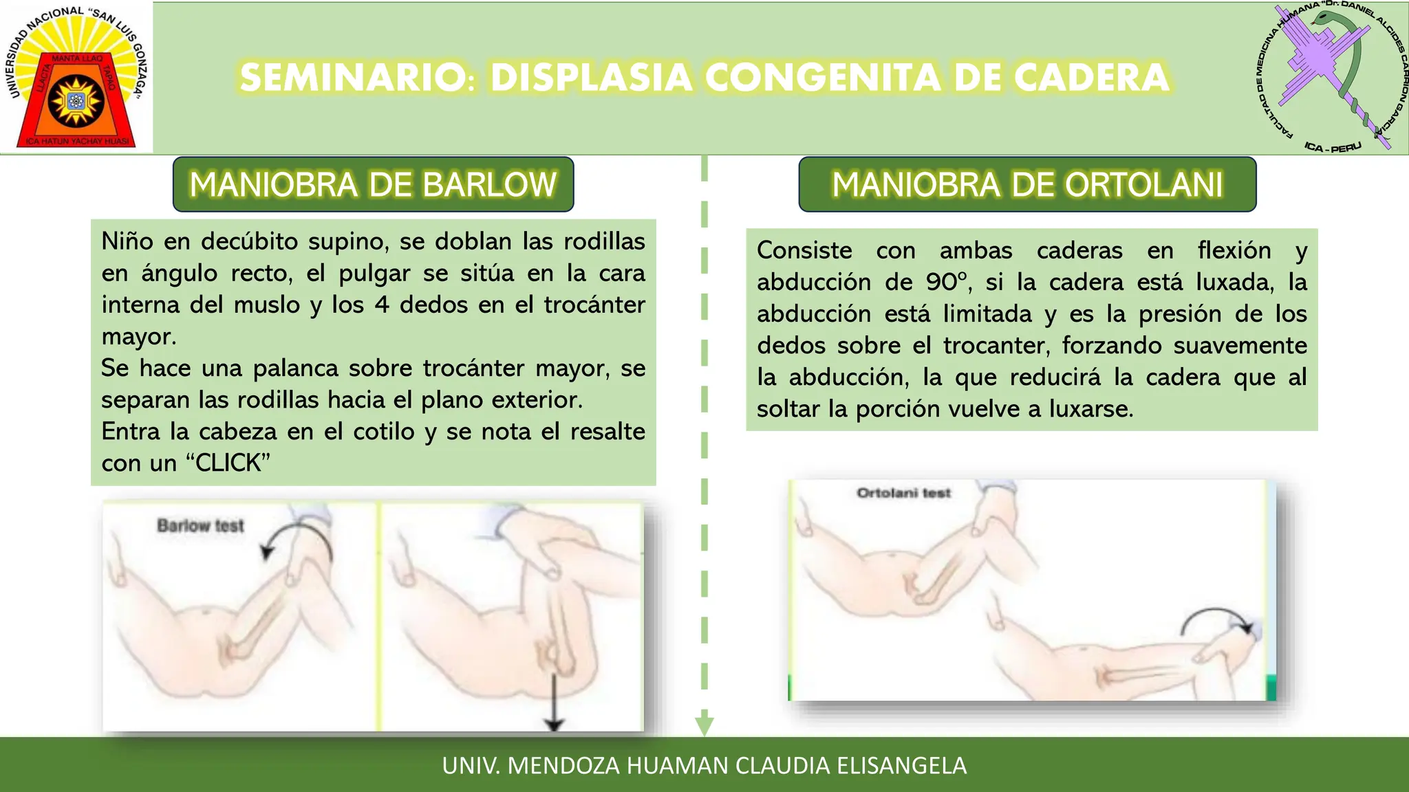 SEMINARIO DISPLASIA CONGENITA DE CADERA^J GENU VARO^J GENU VALGO Y PIE ...