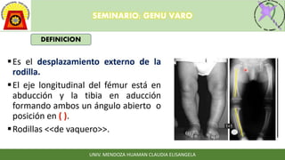 SEMINARIO DISPLASIA CONGENITA DE CADERA^J GENU VARO^J GENU VALGO Y PIE ...
