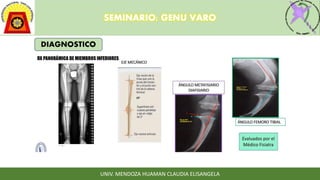 SEMINARIO DISPLASIA CONGENITA DE CADERA^J GENU VARO^J GENU VALGO Y PIE ...