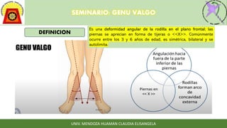 SEMINARIO DISPLASIA CONGENITA DE CADERA^J GENU VARO^J GENU VALGO Y PIE ...