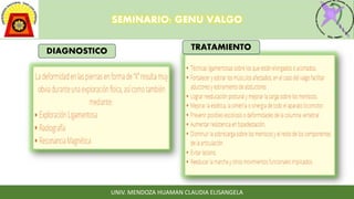 SEMINARIO DISPLASIA CONGENITA DE CADERA^J GENU VARO^J GENU VALGO Y PIE ...