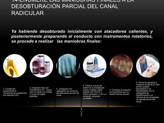 Seminario endodoncia parte 3 | PPTX