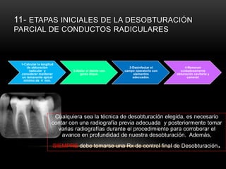Seminario endodoncia parte 3 | PPTX