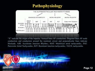 Atrial fibrillation quick review | PPTX