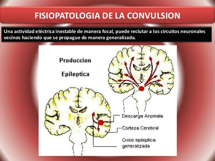 fisiopatologia convulsiones y epilepsias