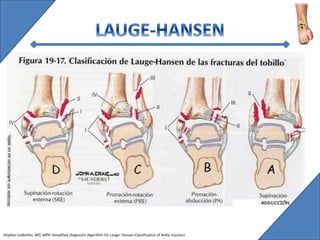 FRACTURAS DE TOBILLO | PPT
