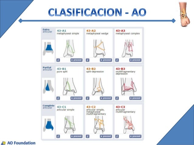 FRACTURAS DE TOBILLO